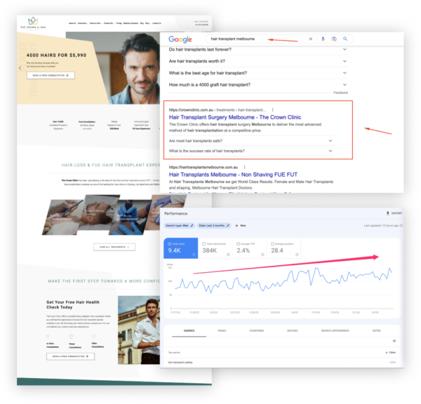 Automated Sales Funnel for Hair Transplant Clinics By OMD